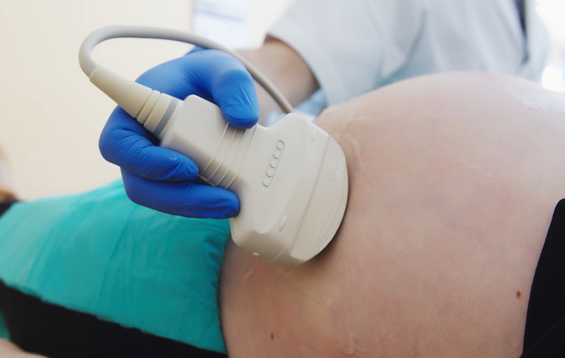 Buitenbaarmoederlijke zwangerschap - Slingeland Ziekenhuis